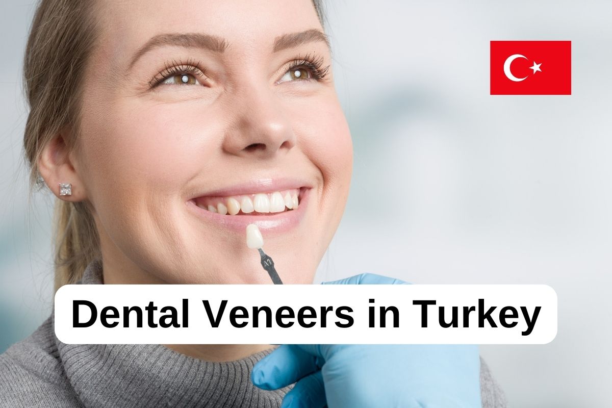 Veneers in Turkey: Guide, Cost and Review - Denthub