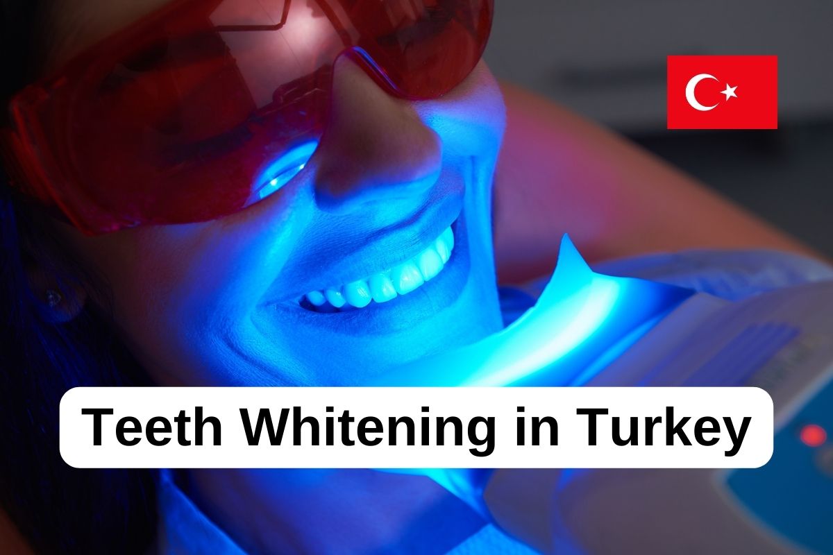 Teeth Whitening in Turkey: A Comprehensive Guide - Denthub